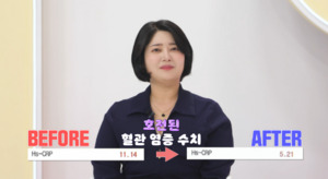 줄여주는 비서들, SNS 보정 여신 등장… 쥬비스 다이어트 후 23.7kg 감량 눈길 - 스타데일리뉴스